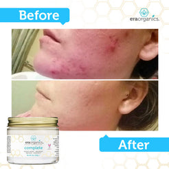 Face moisturizer cream - Nourish Dry Sensitive Skin - Eraorganics.com